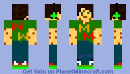 Teen With Acne Minecraft Skin