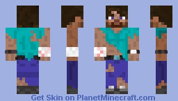Injured Steve Minecraft Skin