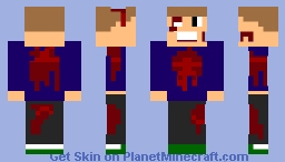 realistic injured player Minecraft Skin