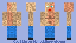 Burn Victim Minecraft Skin