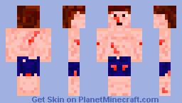 Scratched Human Minecraft Skin