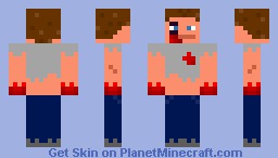 Injured guy Minecraft Skin
